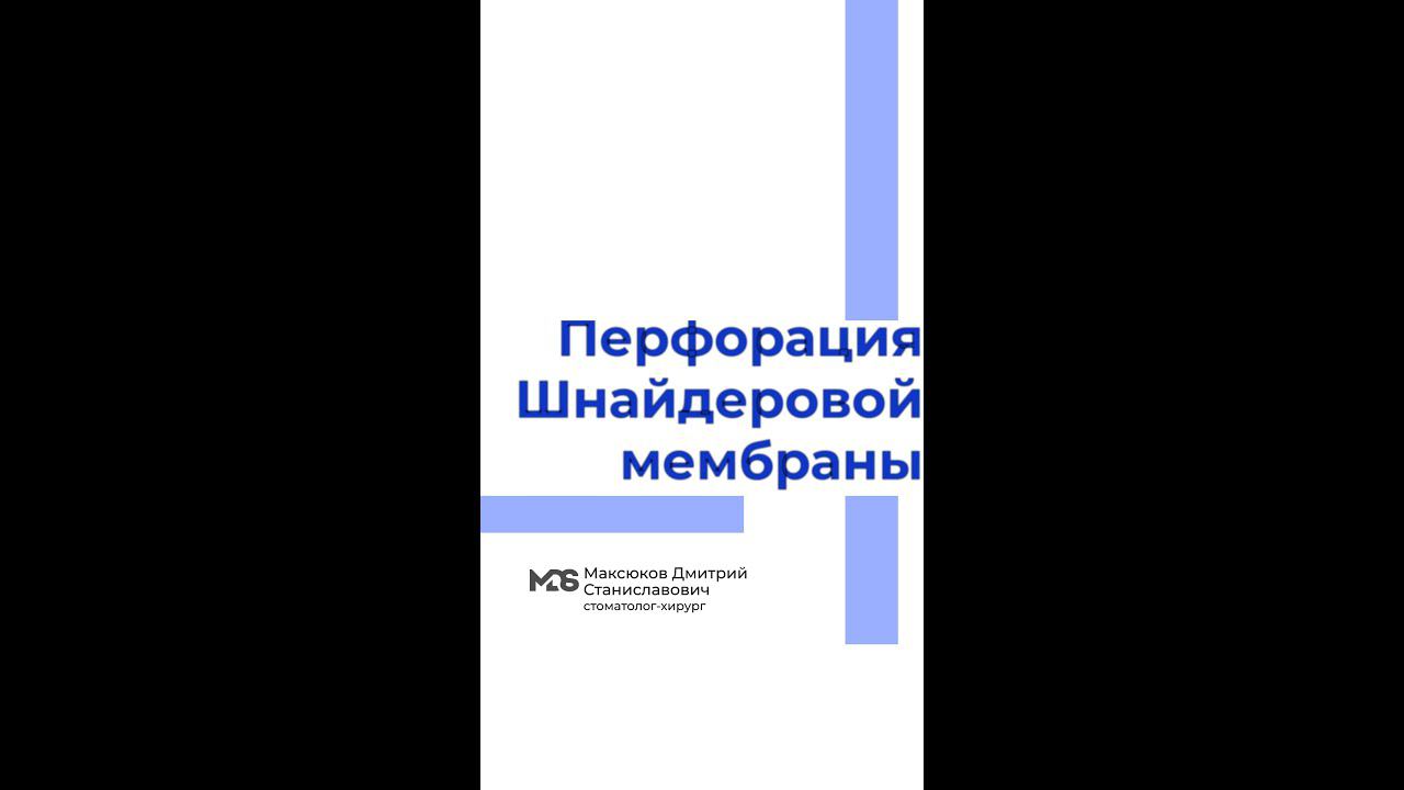 Частота возникновения перфораций Шнайдеровой мембраны