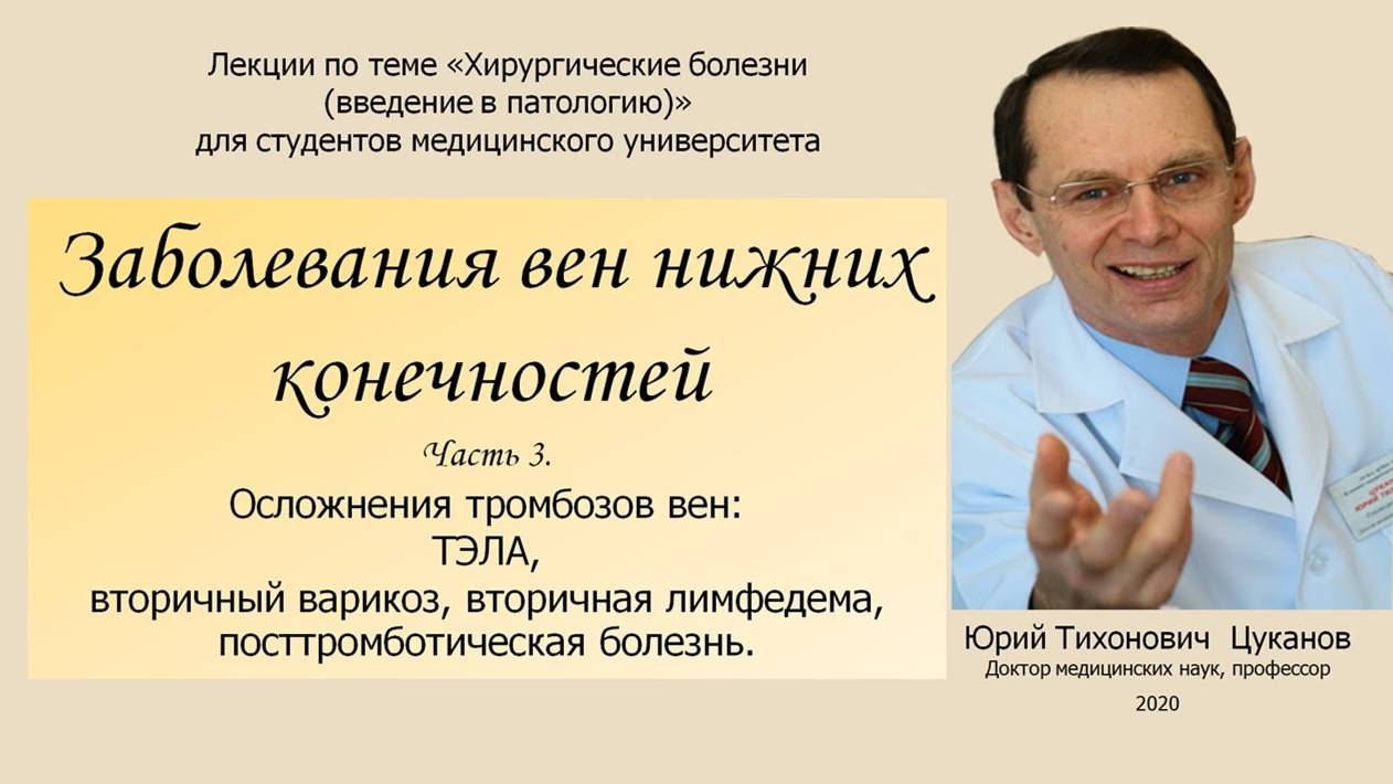 Болезни вен, часть 3.  Осложнения венозного тромбоза.  Лекция для студентов медуниверситета.