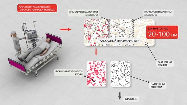 Роснано: мембраны для каскадного плазмафереза