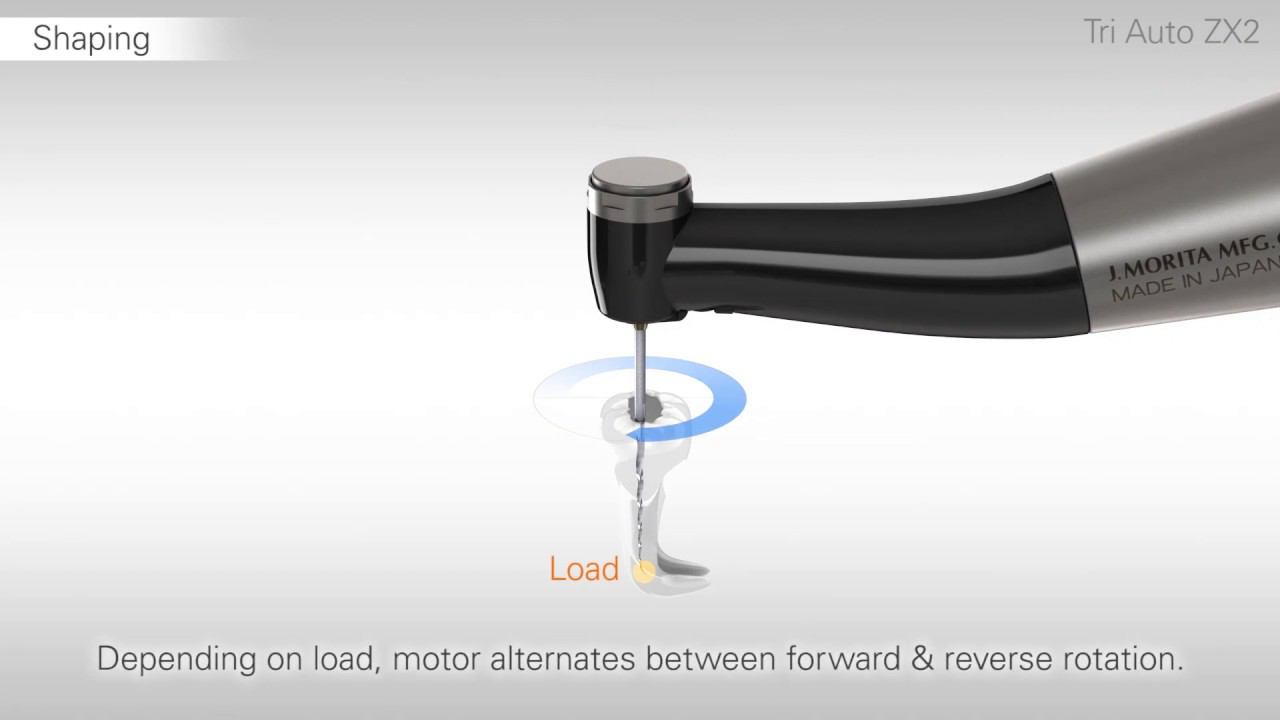 TriAuto ZX2 - Препарирование