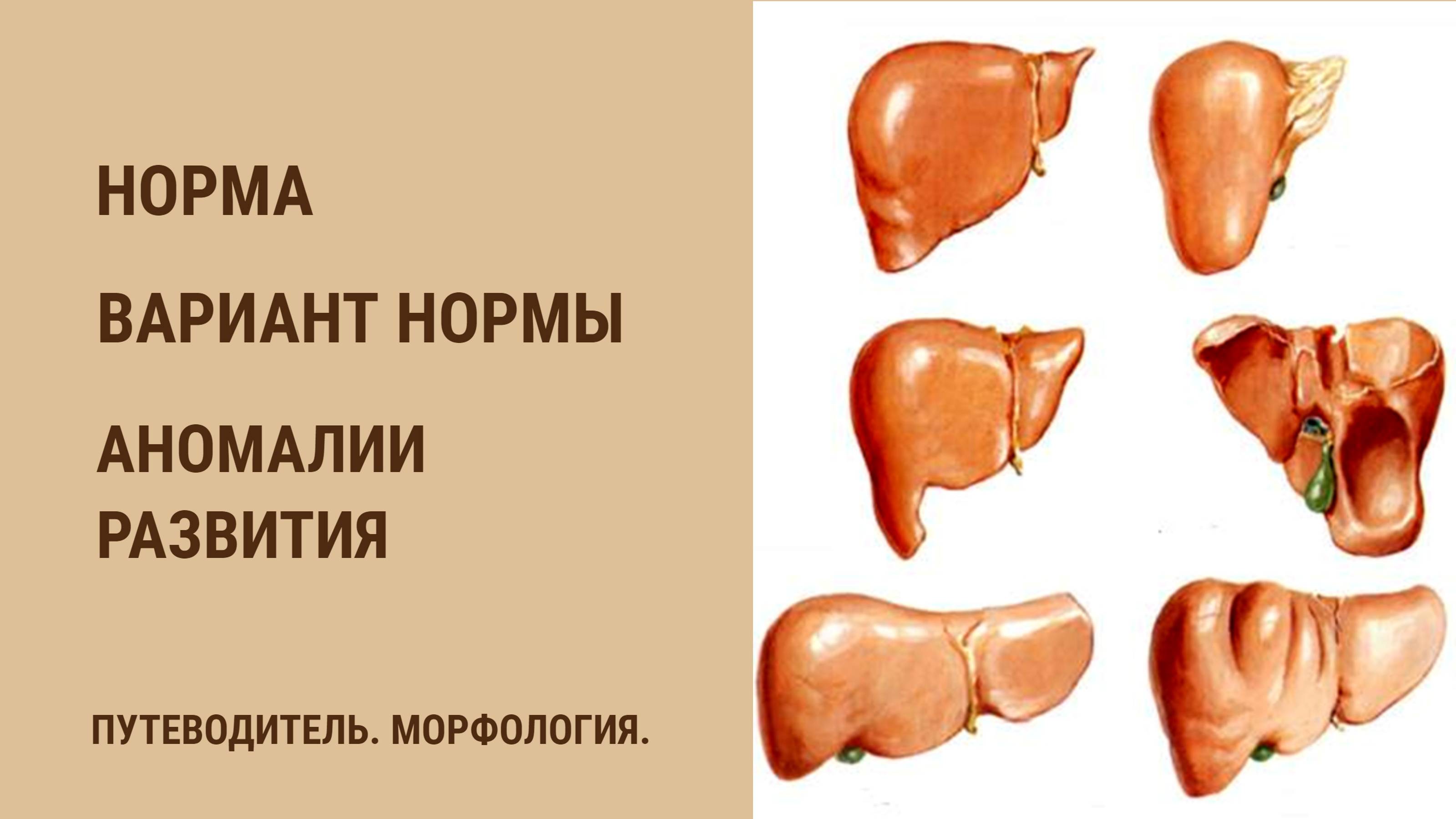 Понятия норма, вариант нормы, аномалии развития в анатомии