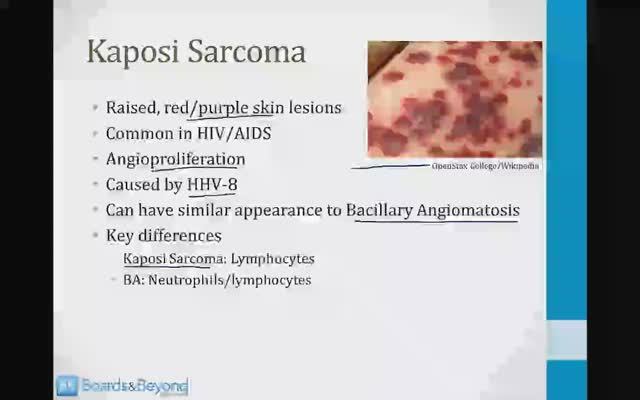 Инфекционные заболевания USMLE - 2. Бактерии - 7.Зоонозные инфекции