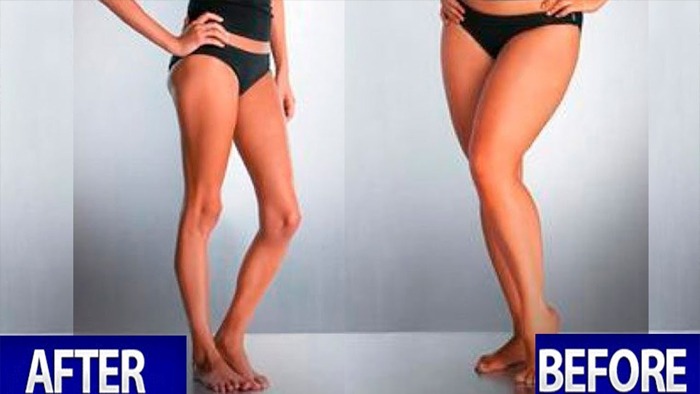 ШОК! ХУДЫЕ НОГИ за 1 ДЕНЬ!!! Как ПОХУДЕТЬ в ляшках и бедрах быстро? РЕАЛЬНО РАБОТАЕТ!