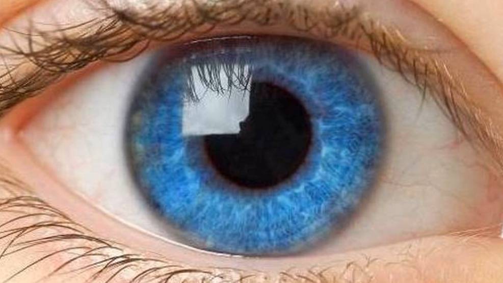 Синдром сухого глаза