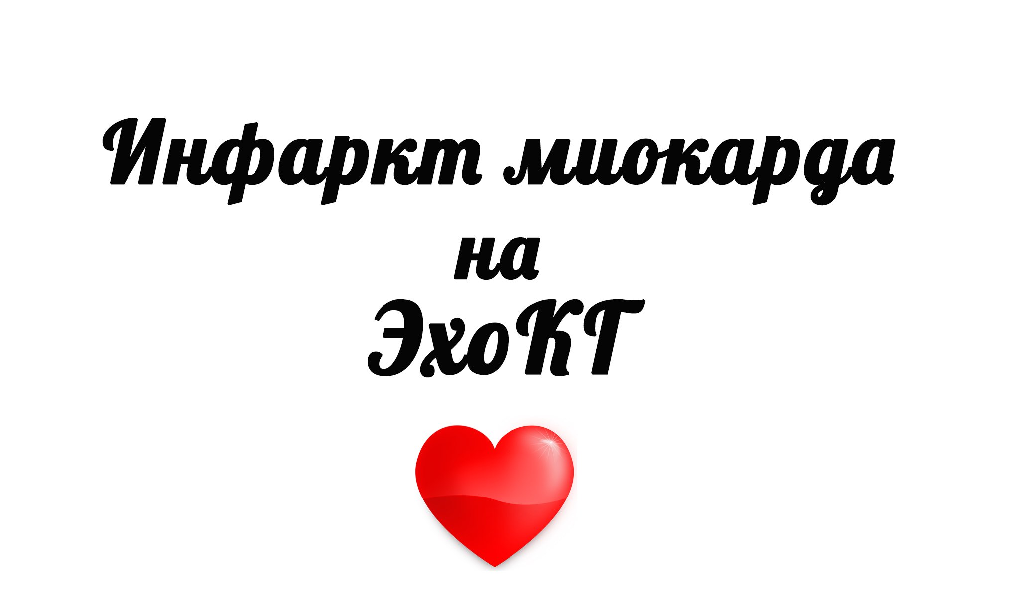 Инфаркт миокарда на УЗИ сердца