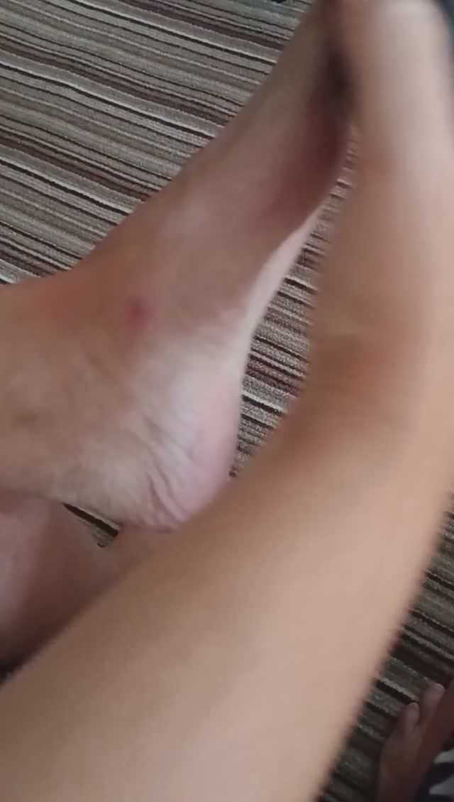 Лайфхак. Как дойти с пляжа если ноги стёрты