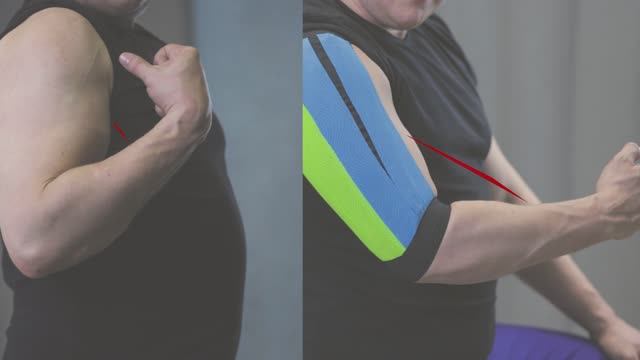 ТЭЙПИРОВАННАЯ КОЖА СДЕРЖИВАЕТ МЫШЦЫ