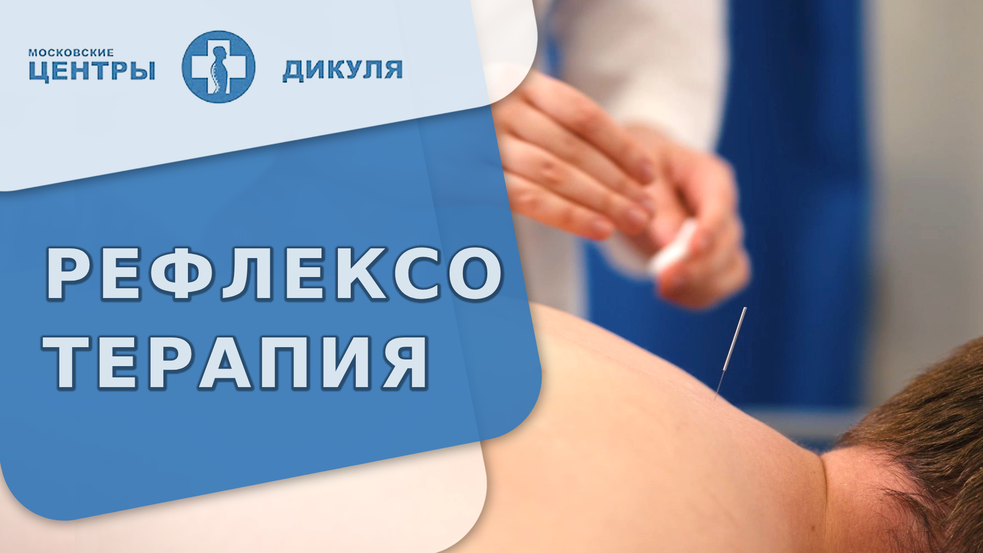 ? Что такое рефлексотерапия, и при каких заболеваниях она показана? Что такое рефлексотерапия. 18+