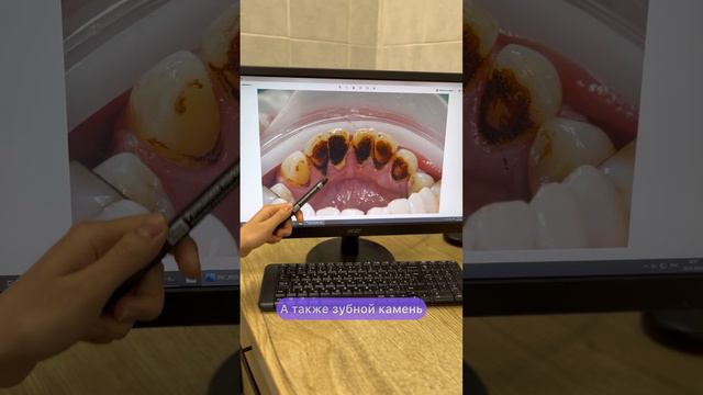 Кейс от Сулеймановой Сабины Эльхановны