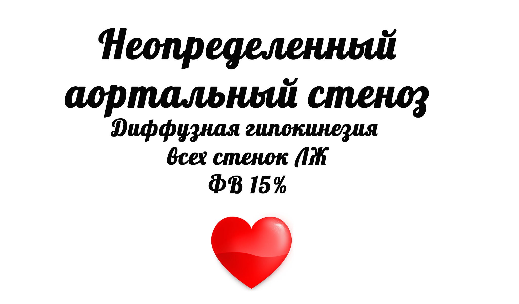 Диффузная гипокинезия всех стенок левого желудочка. ФВ 15%. Неопределенный аортальный стеноз
