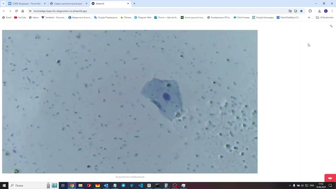 Демонстрация работы ГССПВР в гинекологической цитологии