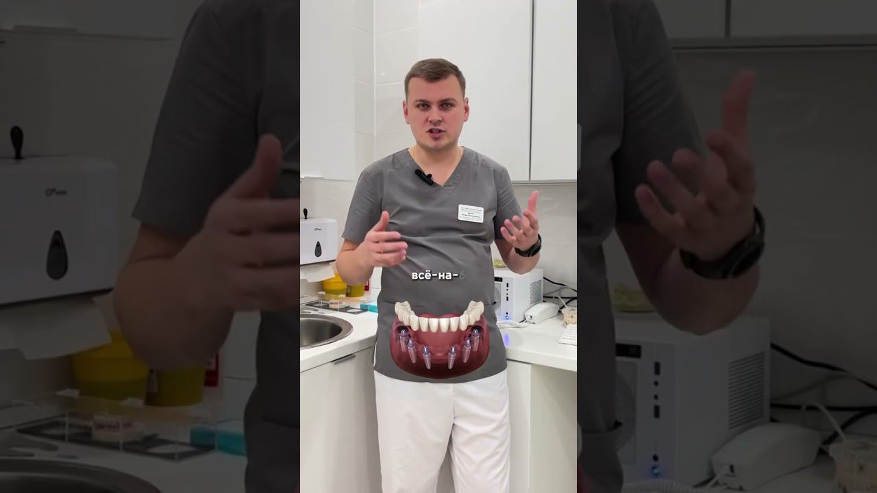 Все на 4 - инновационный метод имплантации #стоматолог #имплантациязубов