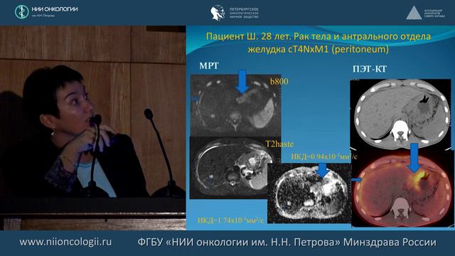МРТ всего тела в онкологической практике