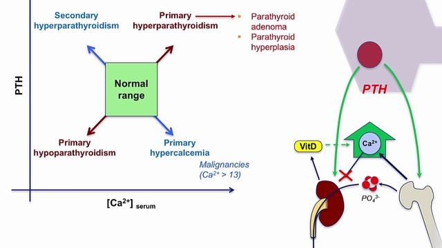 USMLE RX - 3.Эндокринная система - 3.Патология - 13.Гиперпаратиреоз