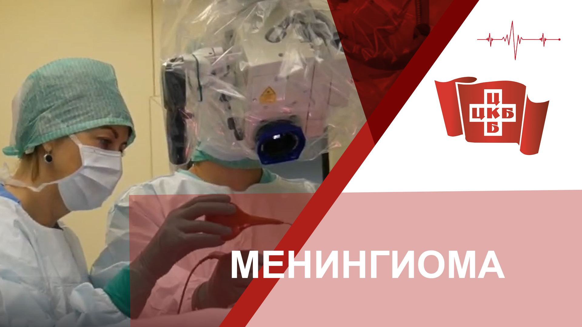 Менингиома