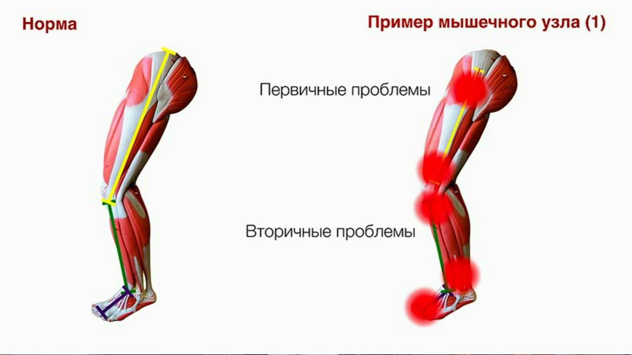 Метод "23+5". Краткая теория - новый взгляд на строение тела.