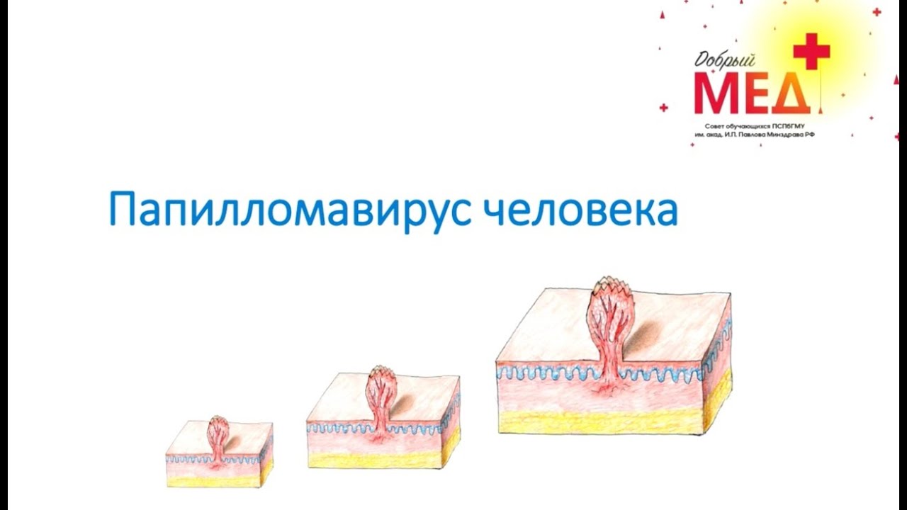 Папилломавирус человека (ВПЧ)  - для средних и старших классов.