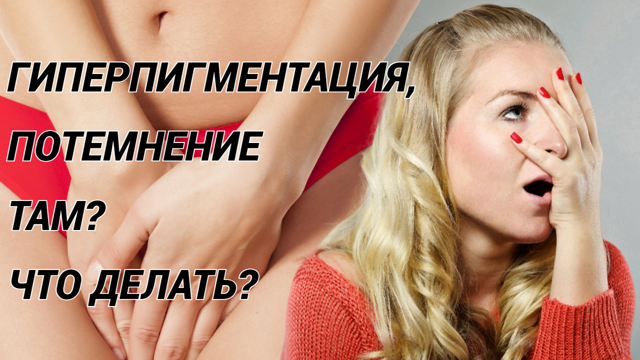 Потемнение половых органов или гиперпигментация интимной зоны: что делать? Как отбелить кожу там?