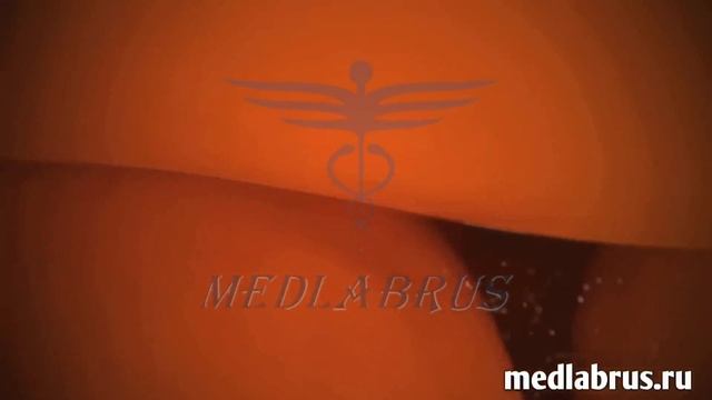 Процесс оплодотворения: путь к зарождению новой жизни