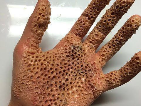 Трипофобия - трогаем осиное гнездо / тест на трипофобию