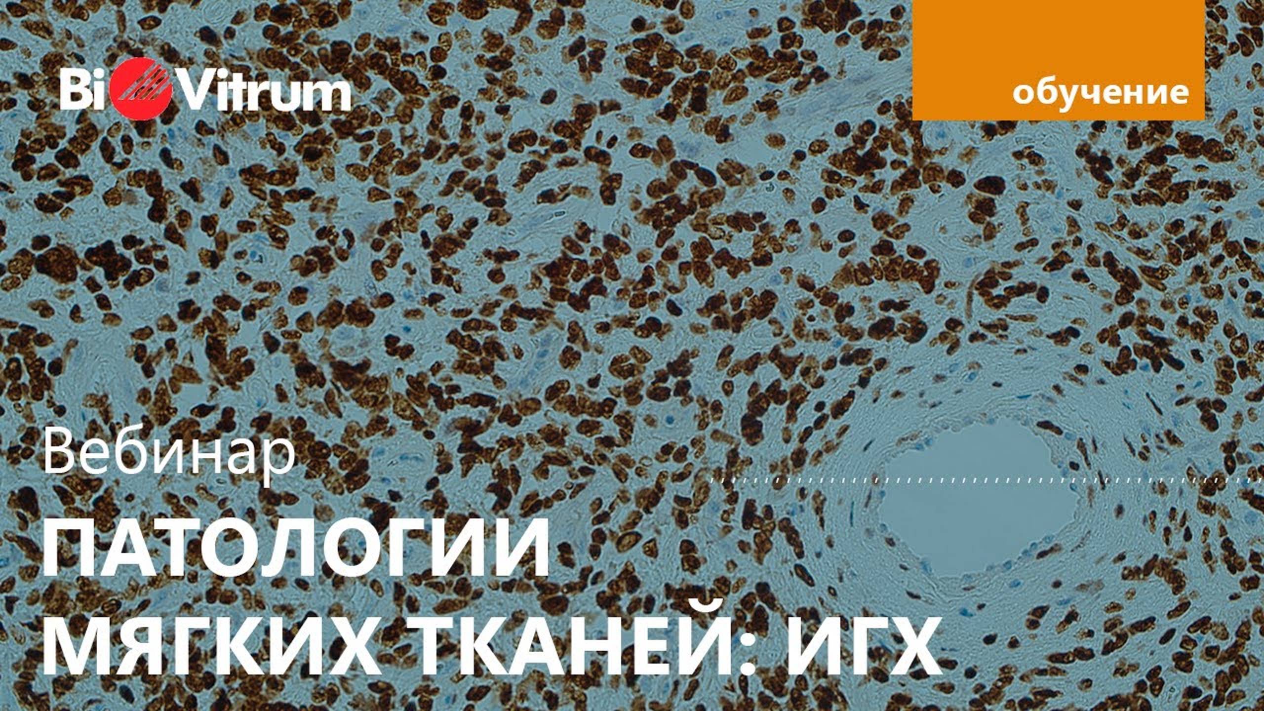 ИГХ-исследования при патологии мягких тканей