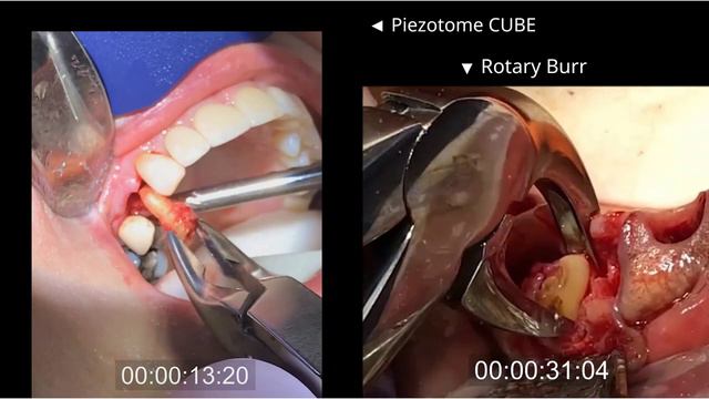 Less Trauma, Less Drama, More CUBE