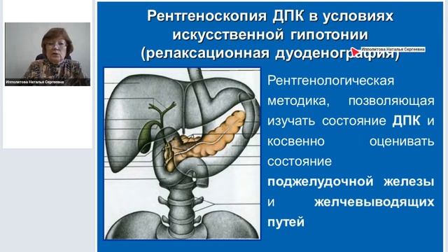 Рентгенологическое исследование двенадцатиперстной кишки.mp4