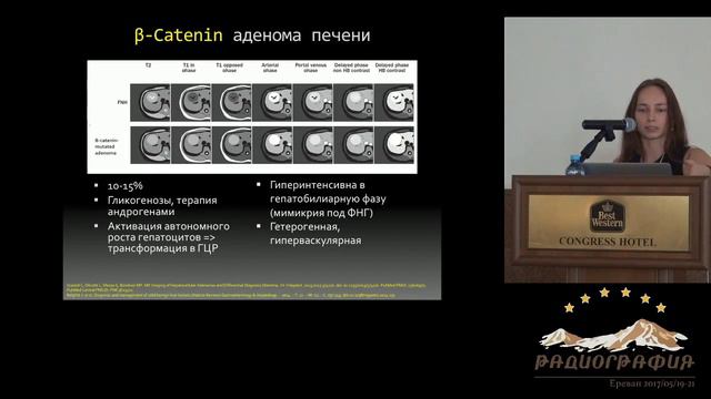 Дифференциальная диагностика гепатоцеллюлярных аденом. Лучевая диагностика