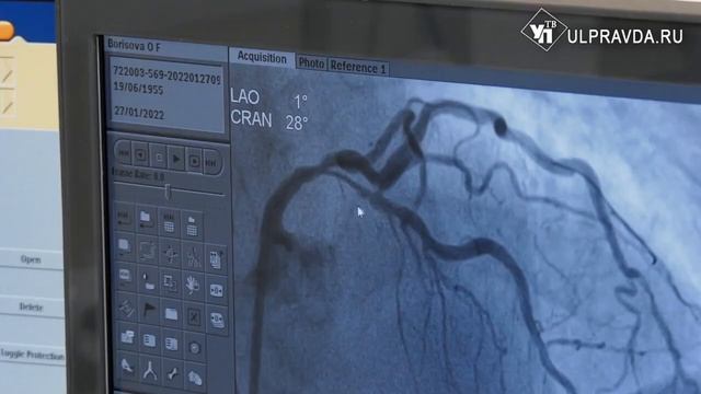 Клиника КатЛаб в Ульяновске операции на сердце по-новому