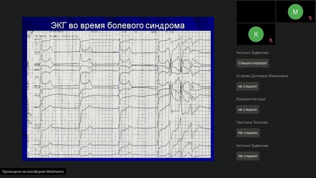 Енисеева ЕС Острый инфаркт миокарда