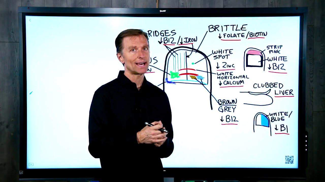О чем говорят ваши ногти?