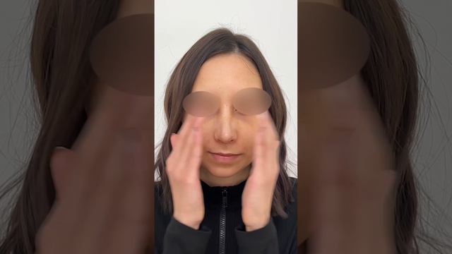 Риносептопластика До и спустя 10 дней сразу после снятия гипса