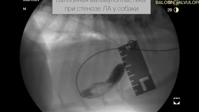 Баллонная вальвулопластика при стенозе легочной артерии у собаки