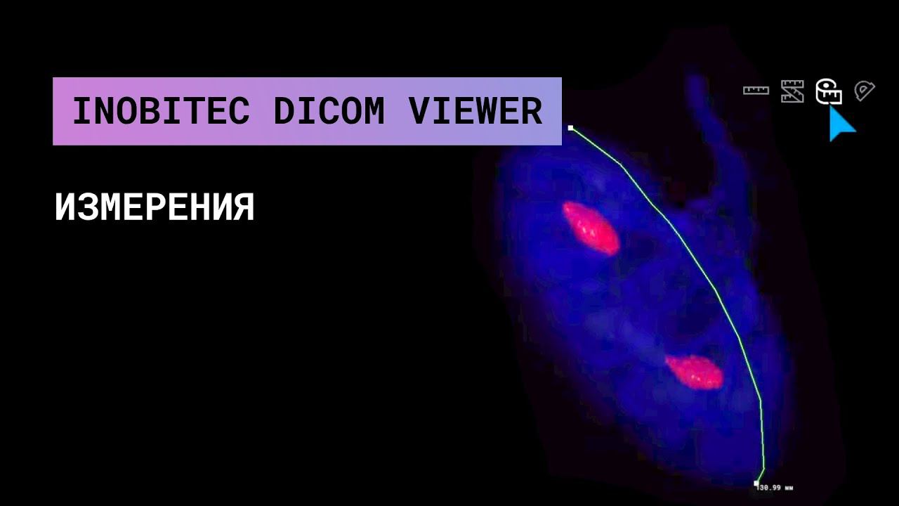 Измерения в Inobitec DICOM Viewer