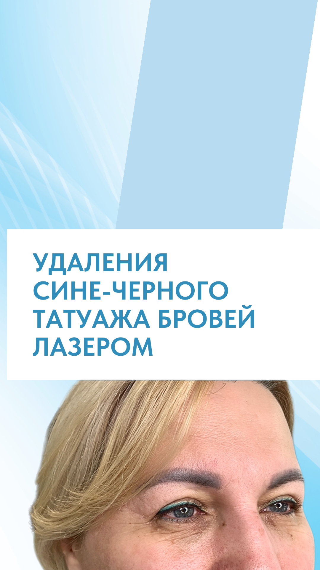 А ВЫ НЕ ВЕРИЛИ | УДАЛИЛИ НЕНАВИСТНЫЙ ТАТУАЖ ЗА ОДИН ВИЗИТ