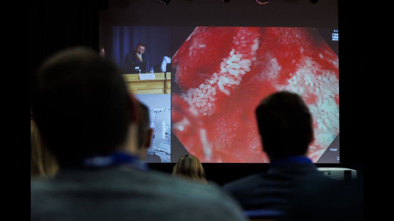 Региональная научно-практическая конференция «Скрининг колоректального рака 18/11/22