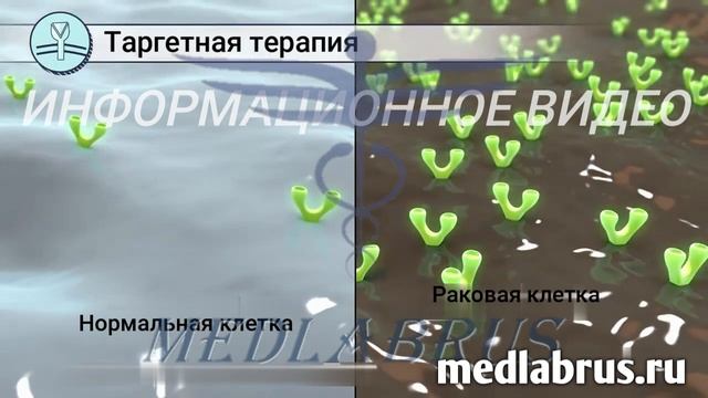 Лейкоз: причины, симптомы и методы лечения