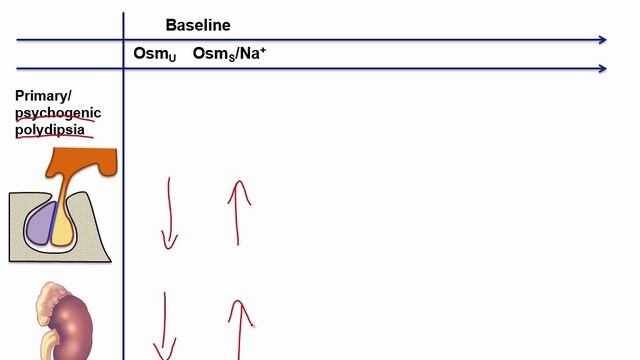 USMLE RX - 3.Эндокринная система - 3.Патология - 6.Несахарный диабет (Diabetes Insipidus)