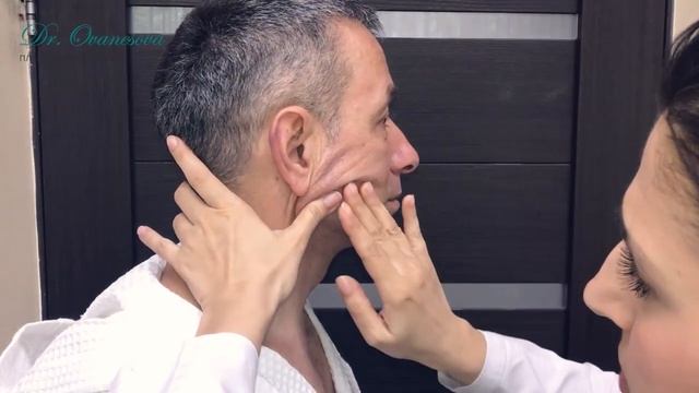 Подтяжка лица и шеи. Перед операцией. Пациент № 24