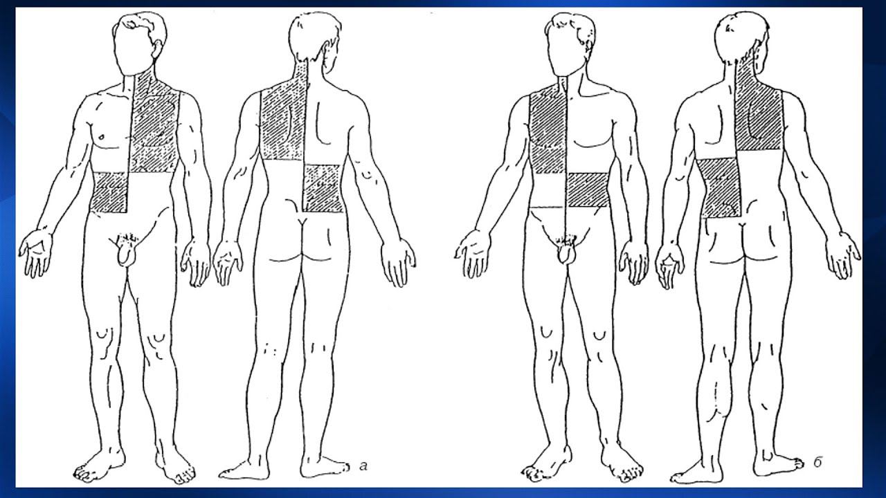 2.17. Интенсивный массаж ассиметричных зон по О.Ф. Кузнецову | Медицинский массаж. Цикл 2