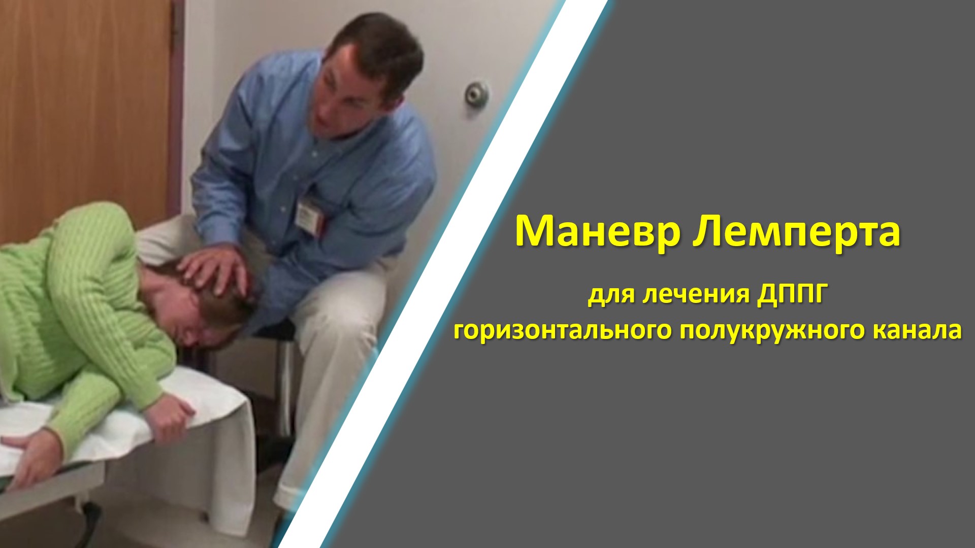 Маневр Лемперта при ДППГ горизонтального полукружного канала | ДППГ