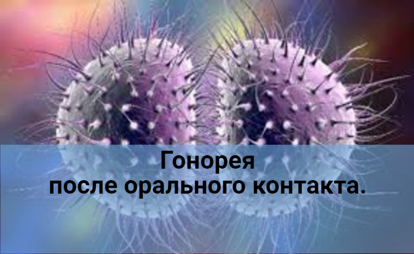 Гонорея после орального контакта.