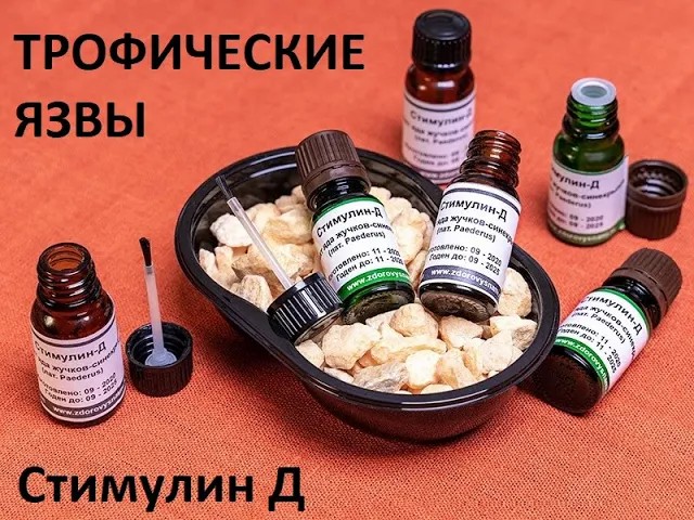 Трофические язвы и Стимулин Д.mp4