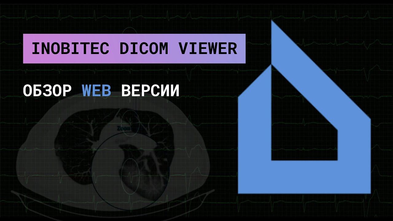Краткий обзор основных возможностей Инобитек Web DICOM-Просмотрщика