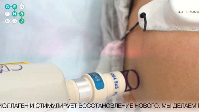 ПРОГРАММА ОМОЛОЖЕНИЯ ЛИЦА, ШЕИ И ЗОНЫ ДЕКОЛЬТЕ NOFILTERS Сеть клиник косметологии GEN87