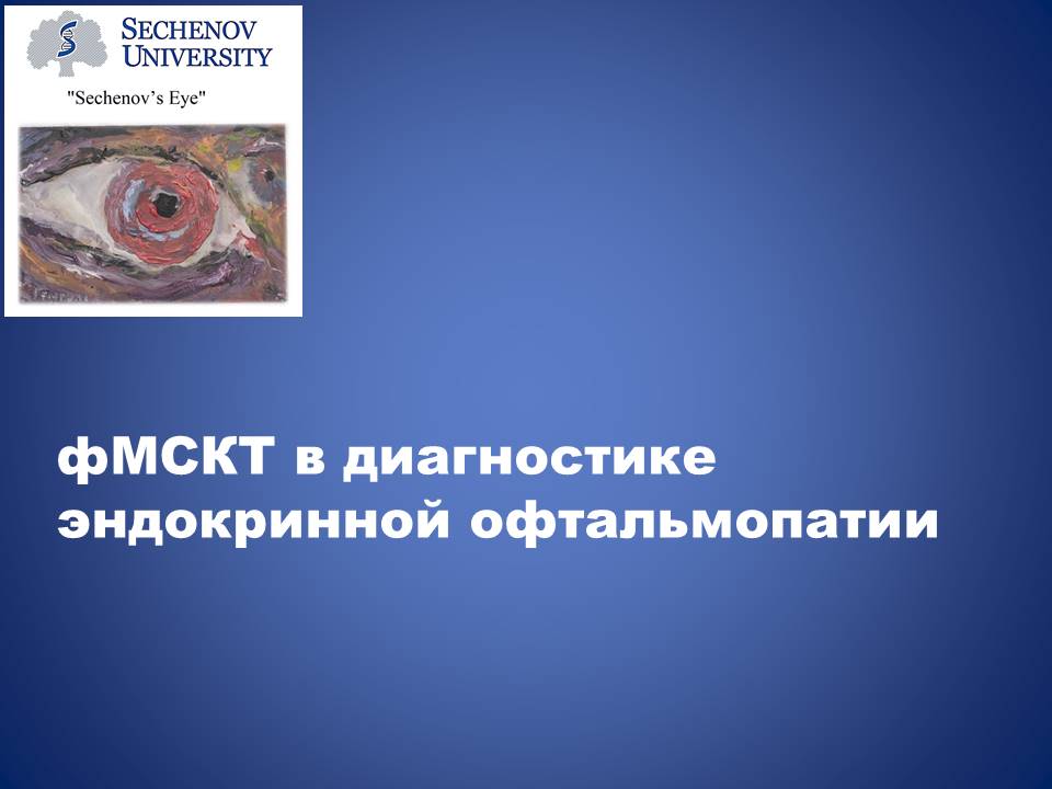 2.фМСКТ в диагностике эндокринной офтальмопатии