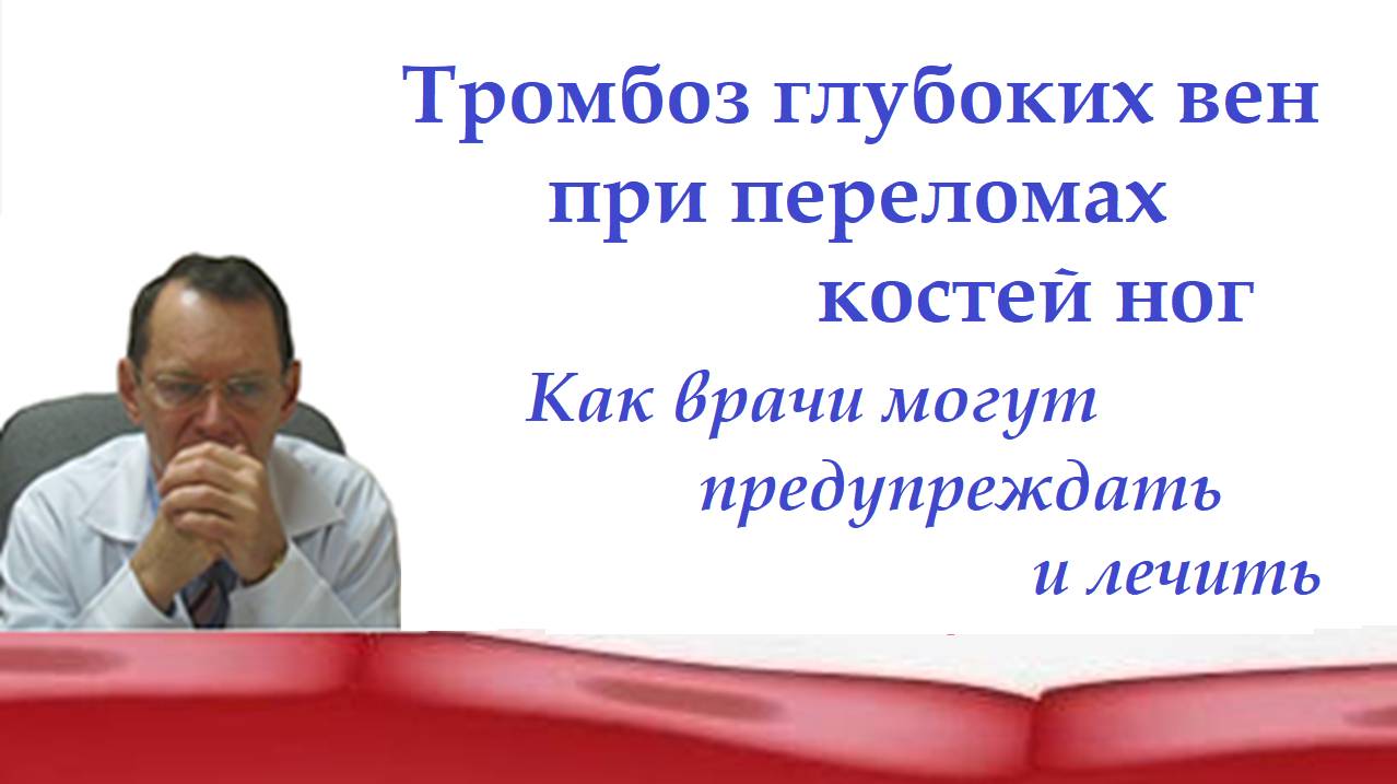 Венозный тромбоз при переломах костей. Как врачи могут лечить. Видеобеседа для ВСЕХ