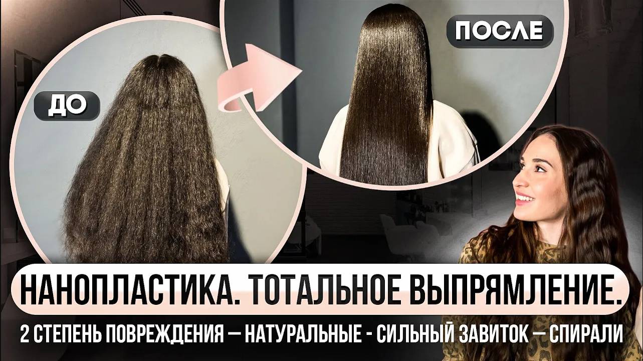 КАК СДЕЛАТЬ НАНОПЛАСТИКУ? Пошаговое проведение процедуры