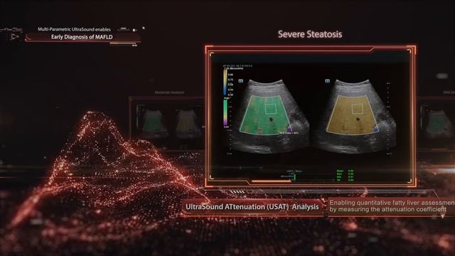 Новый скачок в области  ультразвука: Resona R9
