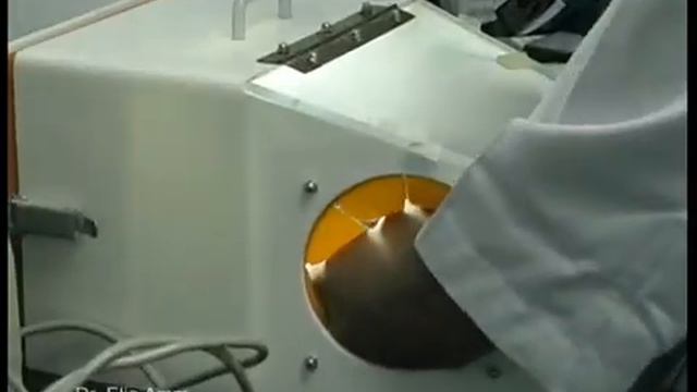 2D — техника непрямой фиксации брекетов